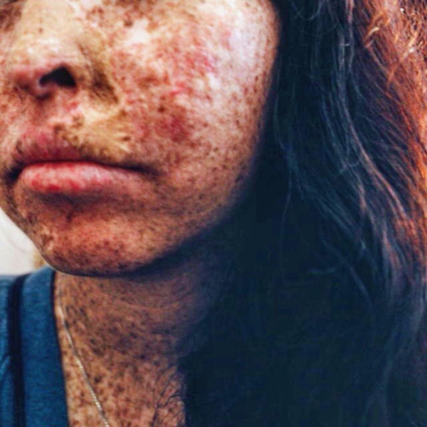 Liga įkalino namuose: neįtikėtina moters istorija | Alfa.lt